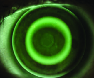 Metro-K - Metro Optics