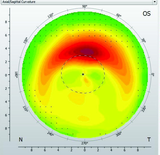ortho-atx-metro-optics